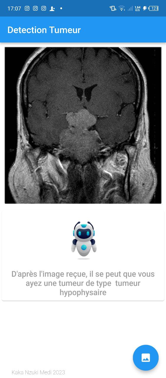 GitHub - Sums-shadow/tumorax