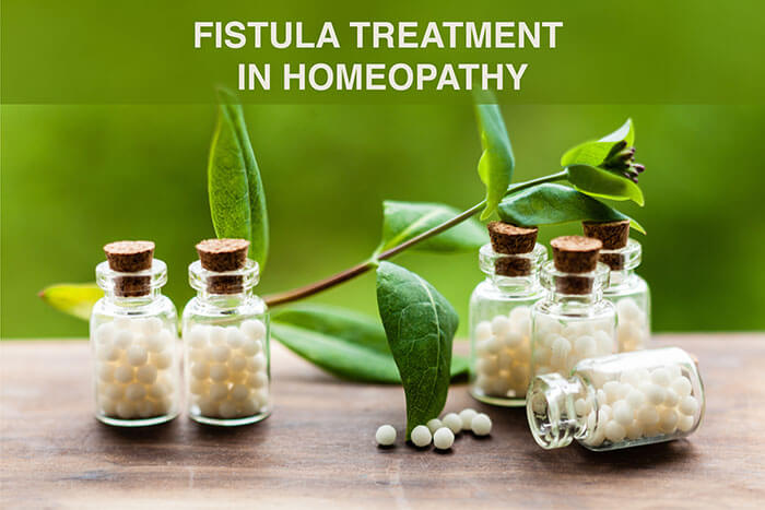 Home Tips To Cure Fistulas