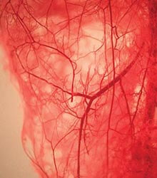 Best Varicose Vein Laser Treatment Surgeon/ Clinic in Gurgaon, South Delhi