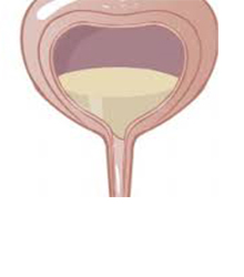 Urethral Stricture Treatment in Gurgaon, Delhi NCR | 100% Painless Surgery